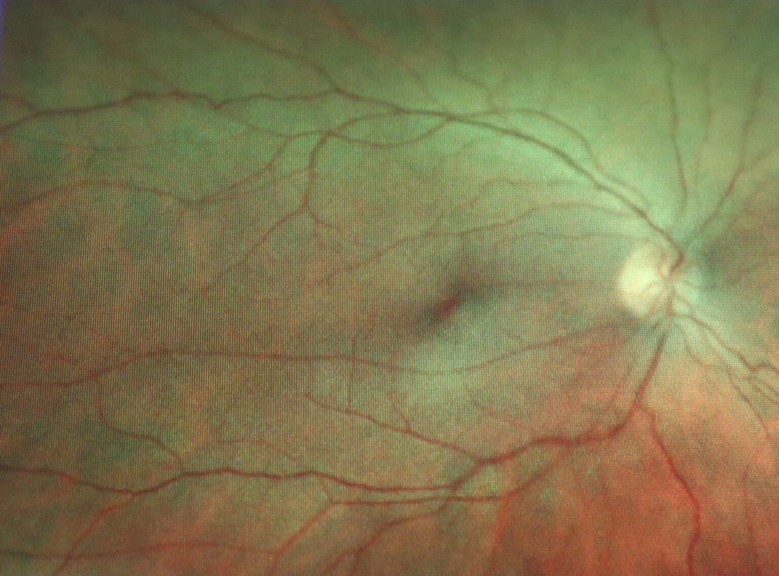 Optomap Retinal Scan - Gareth Roberts Opticians